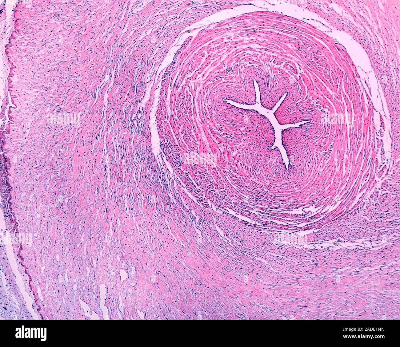 Light micrograph of an umbilical cord showing, from left to right ...
