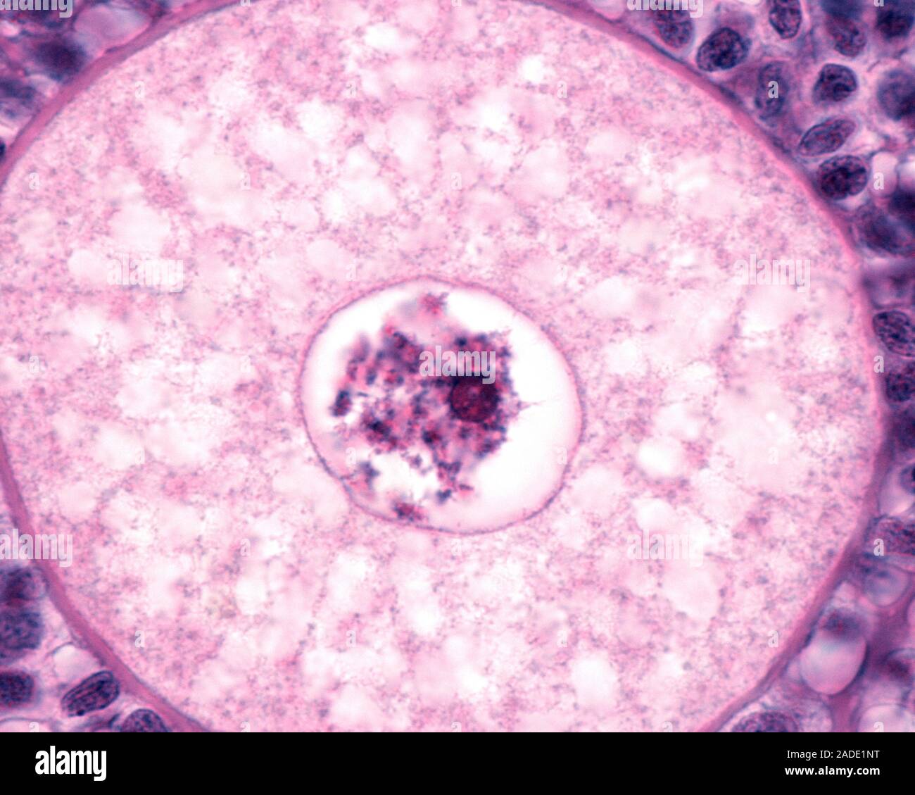 Light micrograph of a primary oocyte located in an ovarian secondary ...
