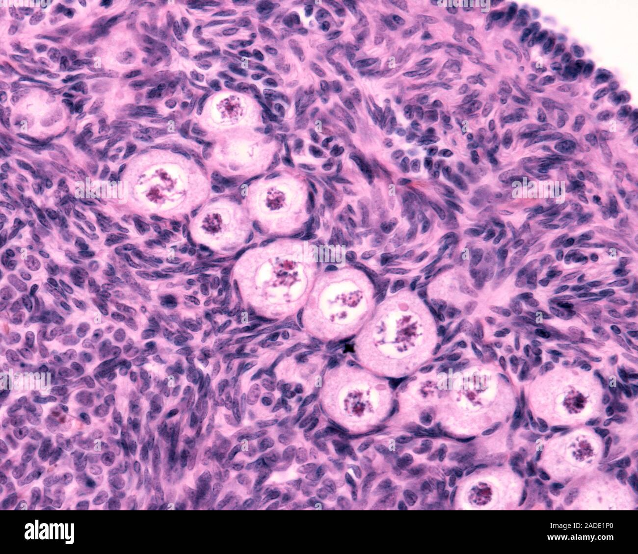 High magnification light micrograph showing primordial ovarian ...