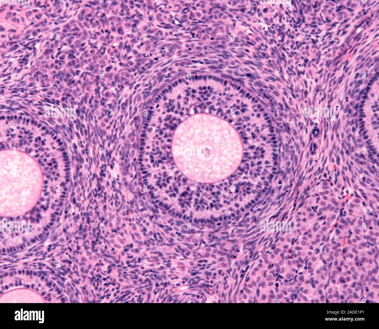 Light micrograph of a secondary follicle showing oocyte, zona pellucida ...