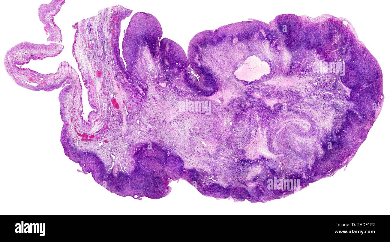 Very Low Magnification Light Micrograph Showing A Whole Menopausal