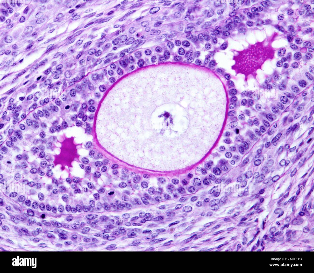 Light micrograph of an ovary stained with the periodic acid of Schiff ...