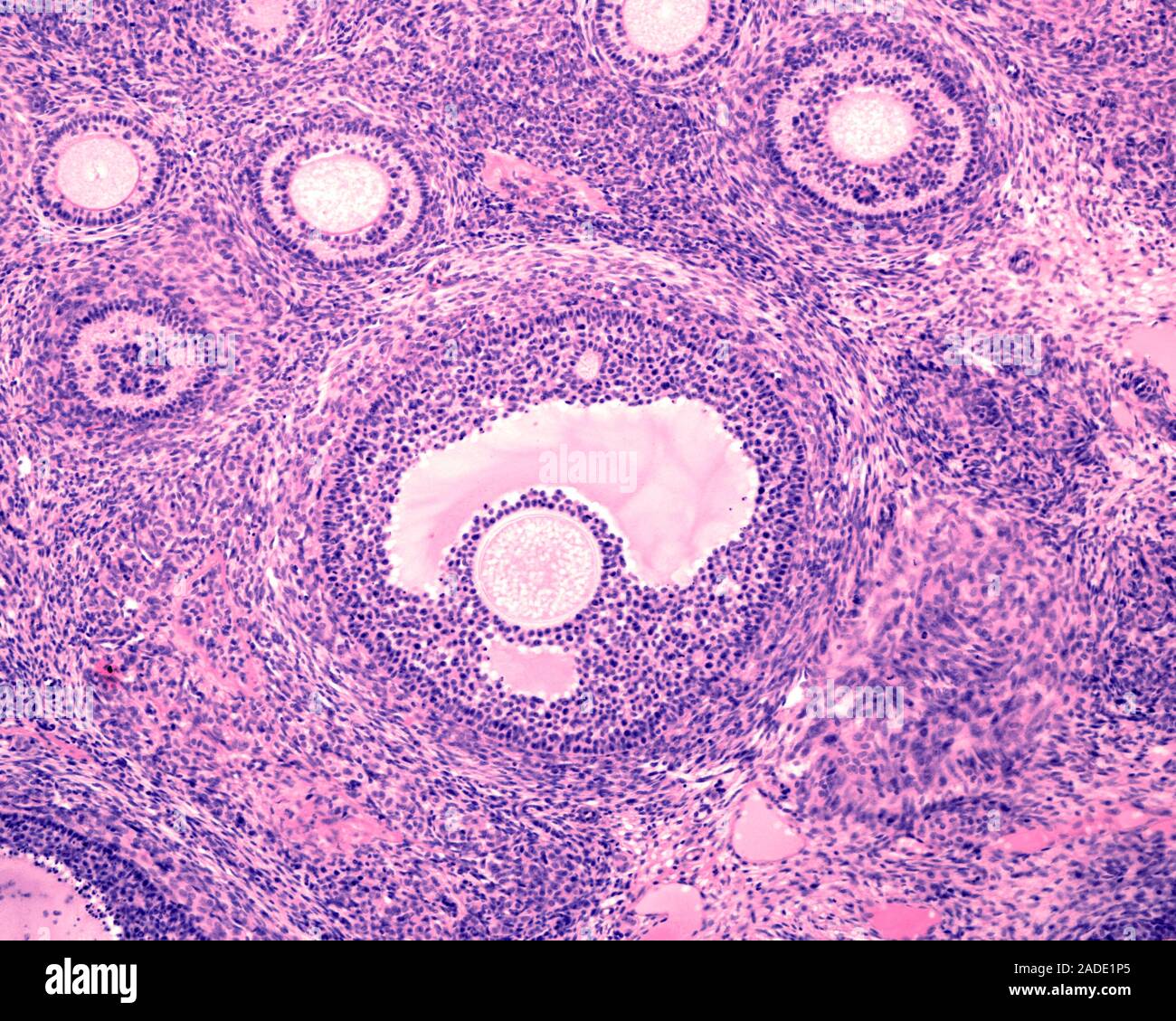 Low magnification light micrograph showing several secondary ovary ...