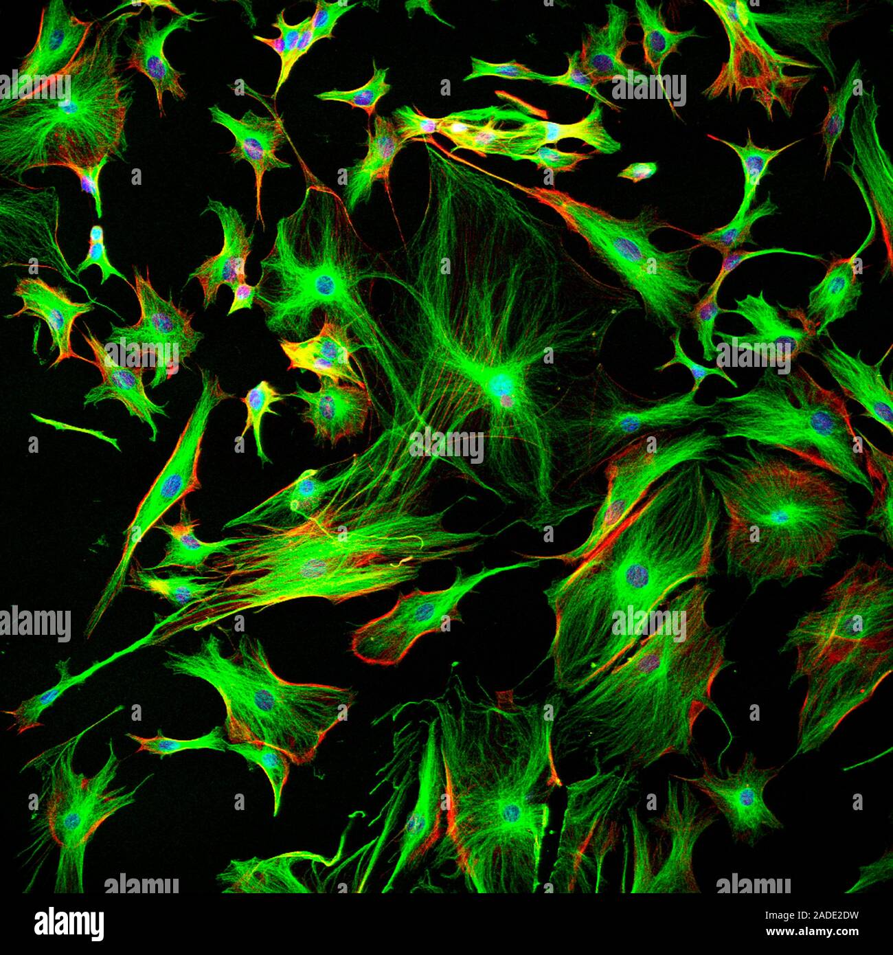 Confocal light micrograph of astrocytes from the brain of a mouse ...