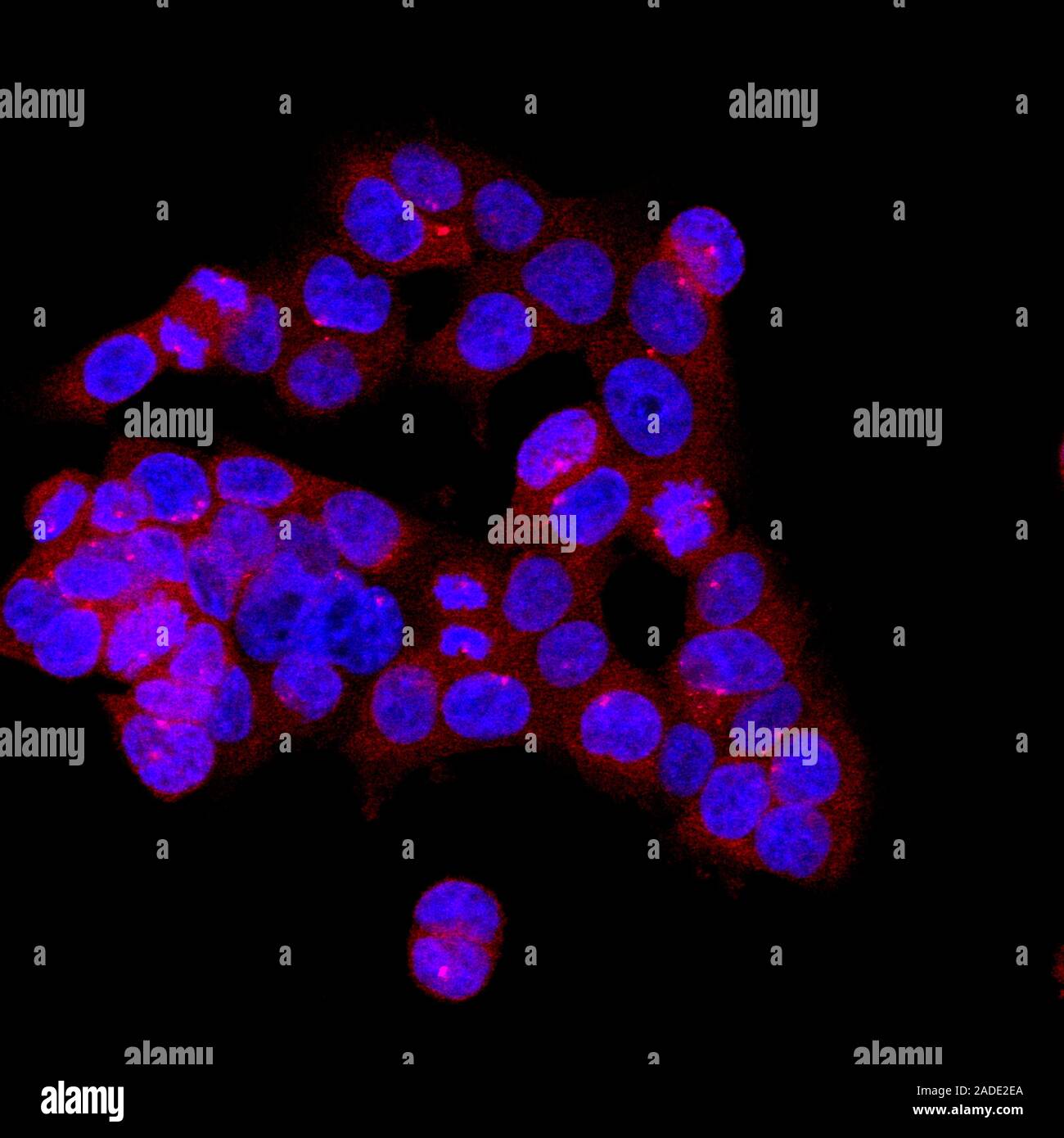 Confocal light micrograph of cultured human colon cancer cells ...