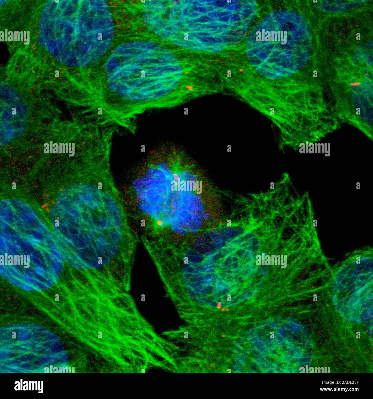 Confocal light micrograph of cultured human colon cancer cells ...