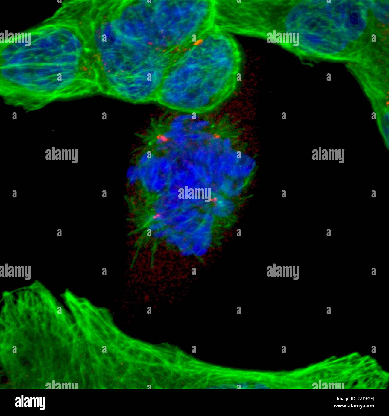 Confocal light micrograph of a cultured human colon cancer cell ...