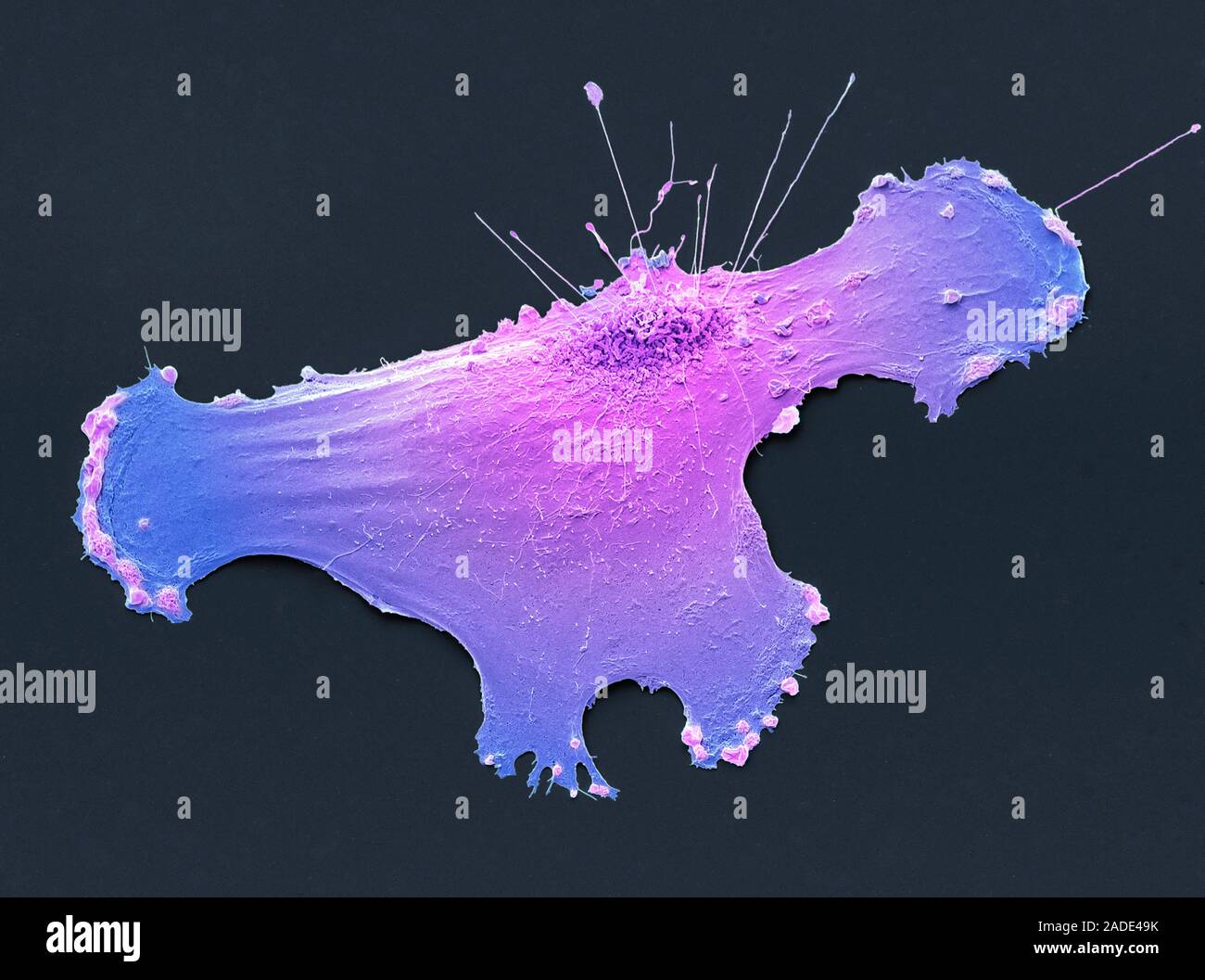 Hepatic stellate cell. Scanning electron micrograph (SEM) of a Hepatic ...