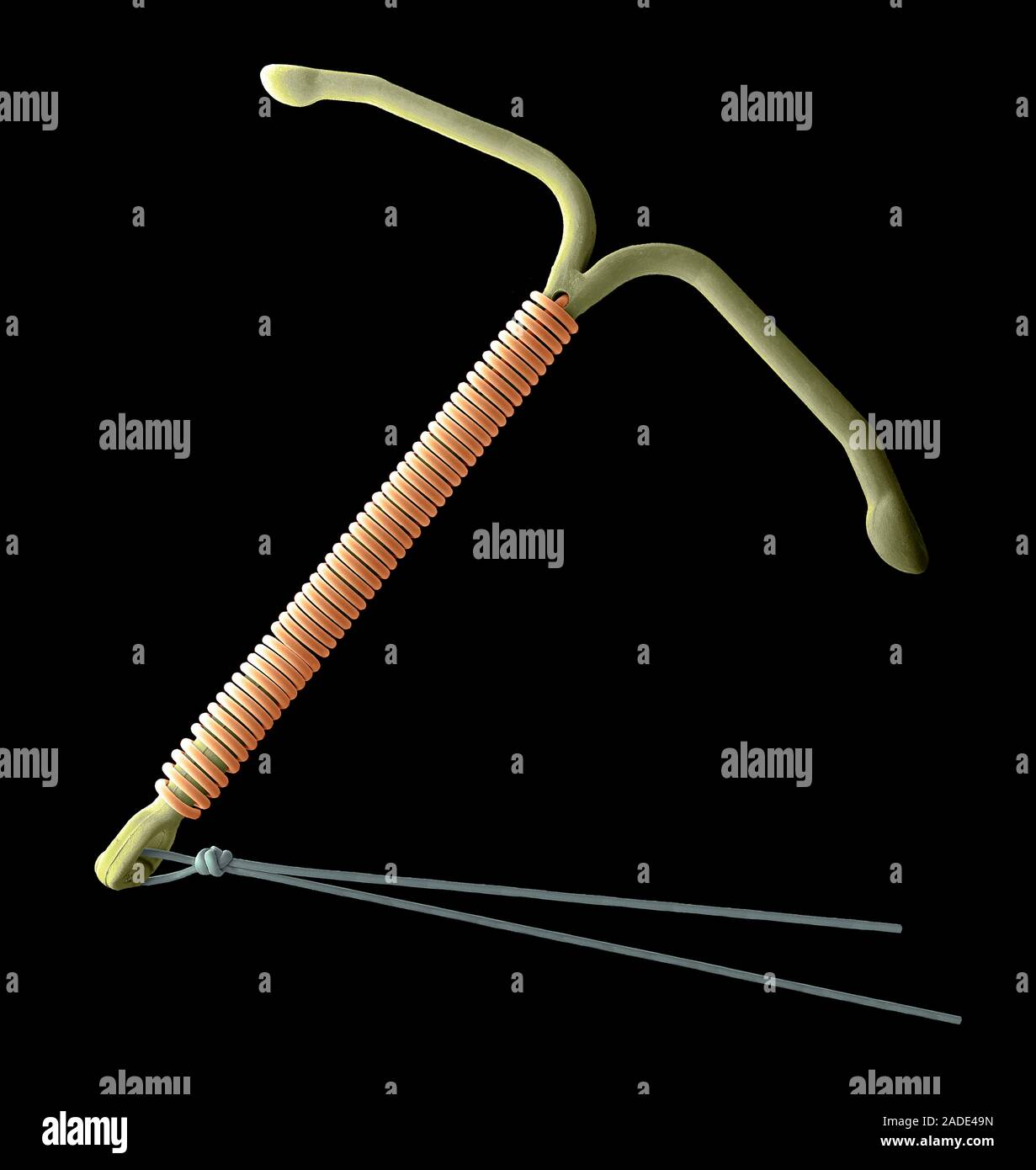 IUD. Coloured scanning electron micrograph (SEM) of a type of ...
