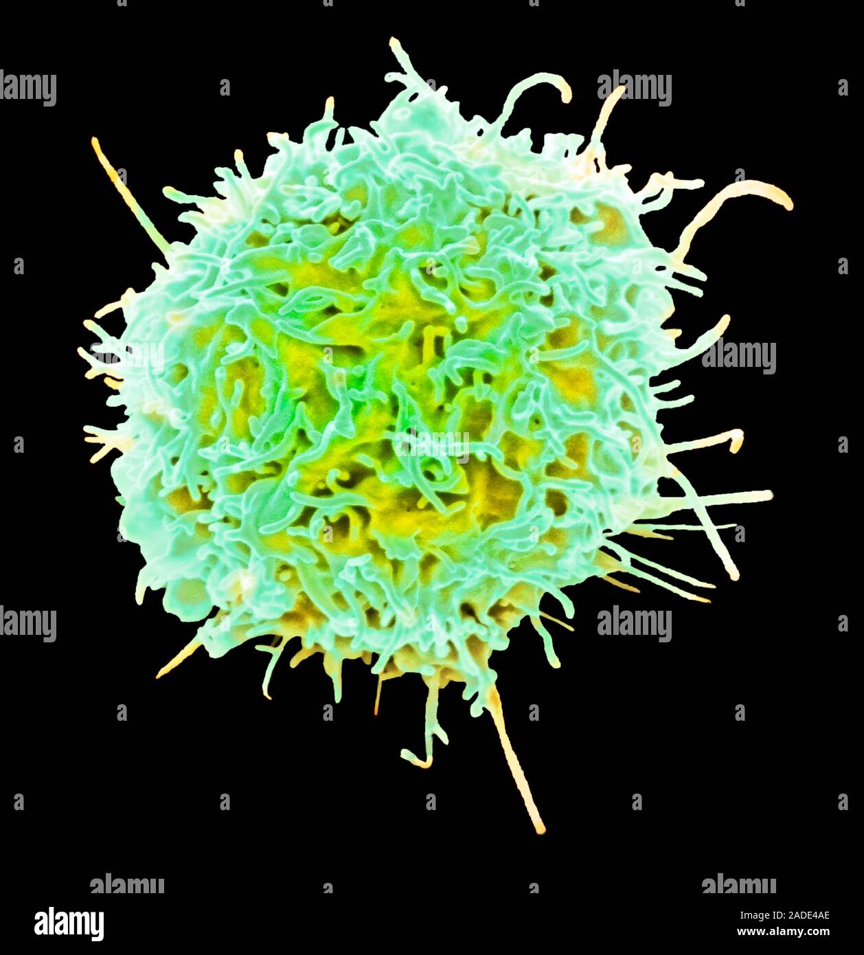 Lymphoma cancer cell. Coloured scanning electron micrograph (SEM) of a ...