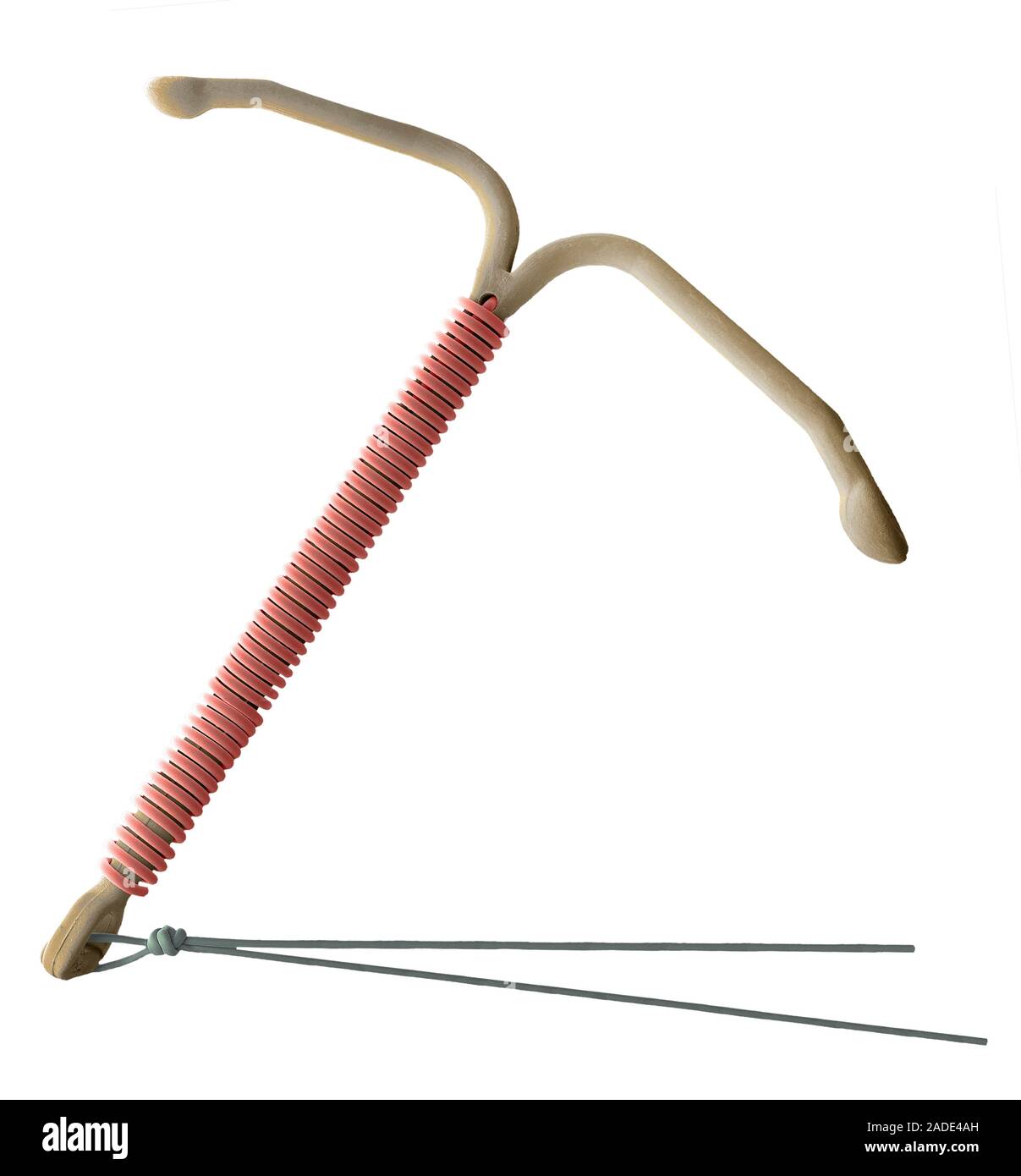 IUD. Coloured scanning electron micrograph (SEM) of a type of ...