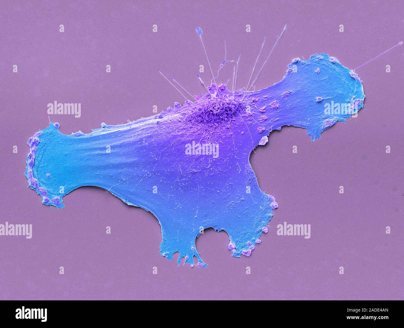 Hepatic stellate cell. Scanning electron micrograph (SEM) of a Hepatic ...