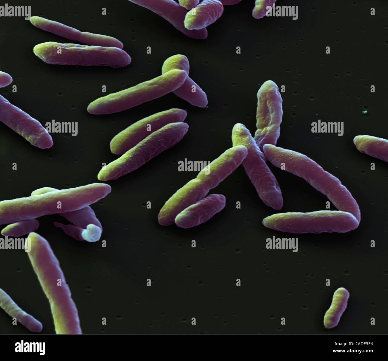 Aeromonas hydrophila bacteria, coloured scanning electron micrograph ...