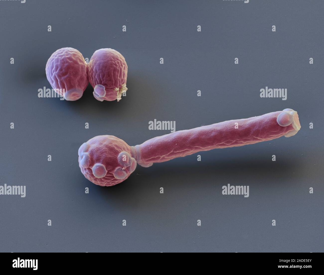 Candida albicans fungus, coloured scanning electron micrograph (SEM ...
