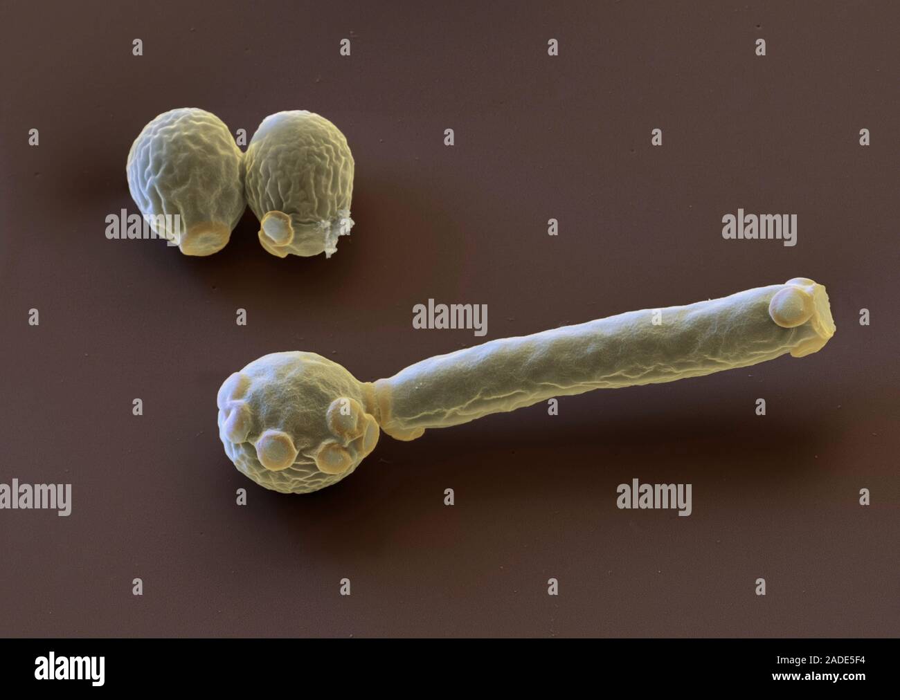 Candida albicans fungus, coloured scanning electron micrograph (SEM ...