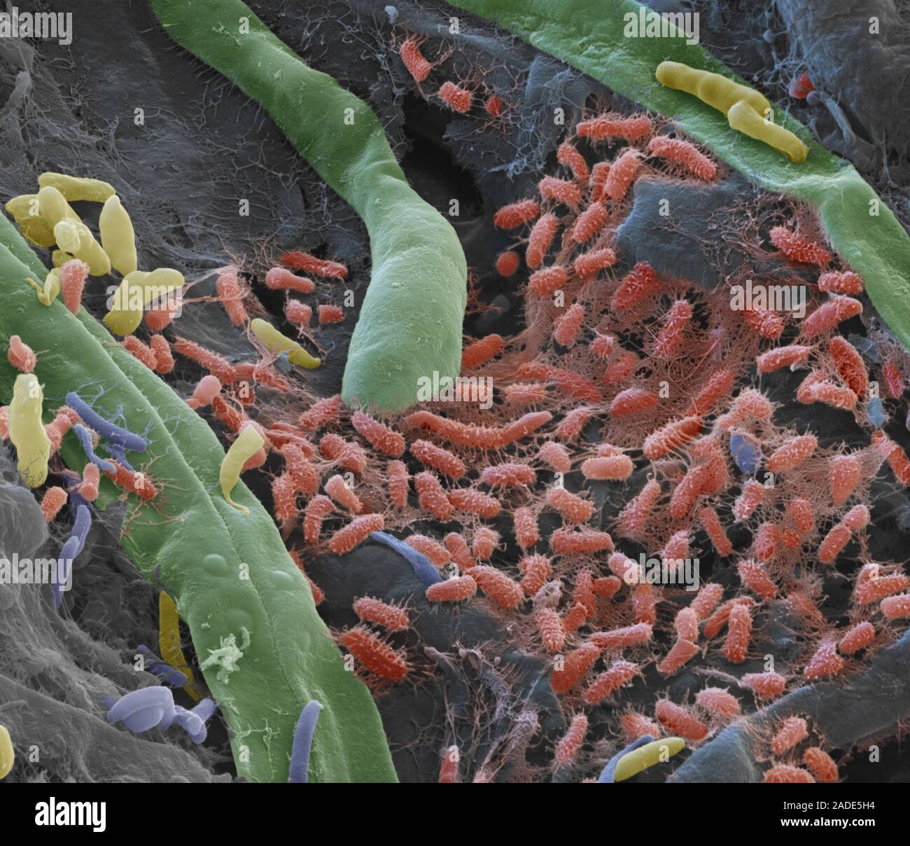 Germs from rubber duck. Coloured scanning electron micrograph (SEM) of ...