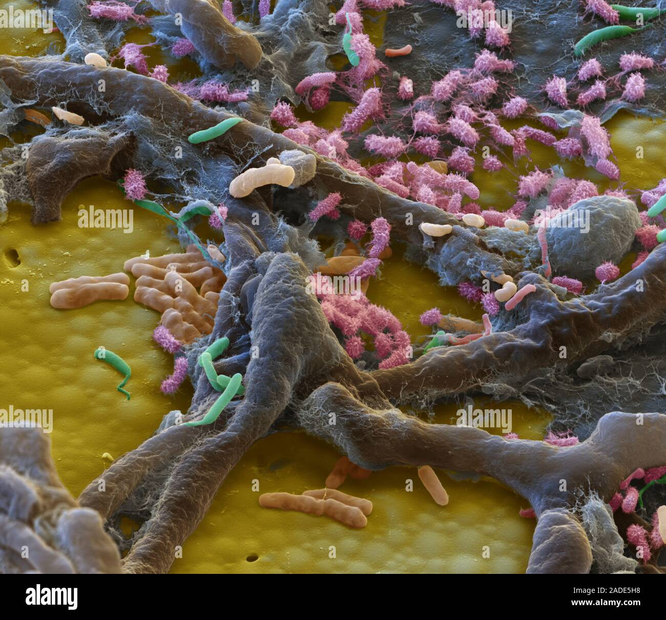 Germs from rubber duck. Coloured scanning electron micrograph (SEM) of ...