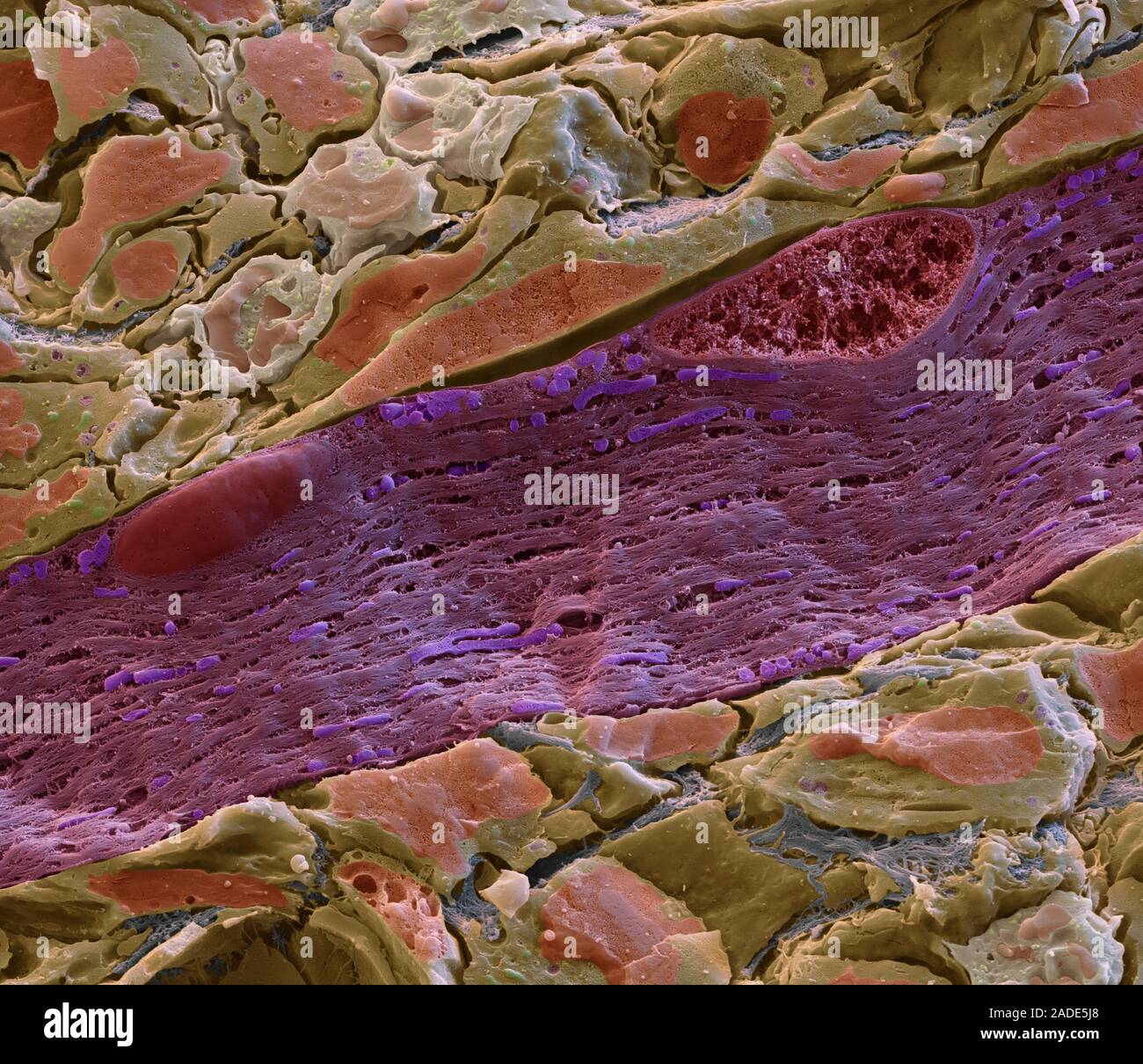 Normal muscle tissue. Coloured scanning electron micrograph (SEM) of a ...