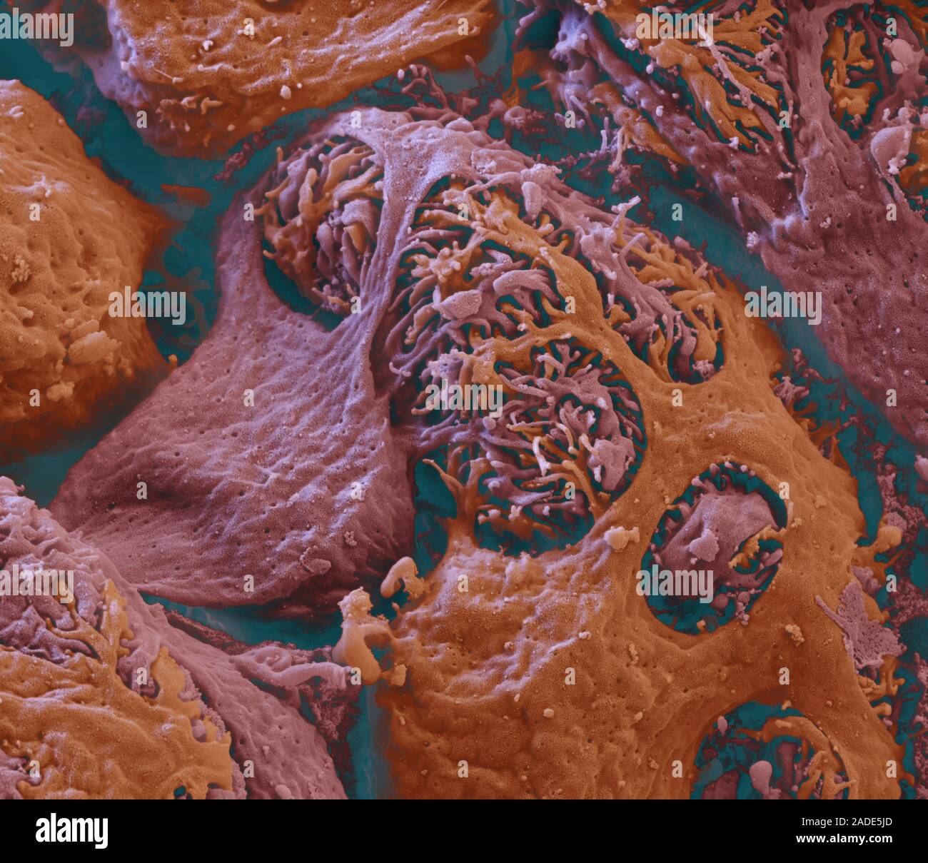 Normal kidney glomerulus. Coloured scanning electron micrograph (SEM ... Normal kidney glomerulus. Coloured scanning electron micrograph (SEM ...