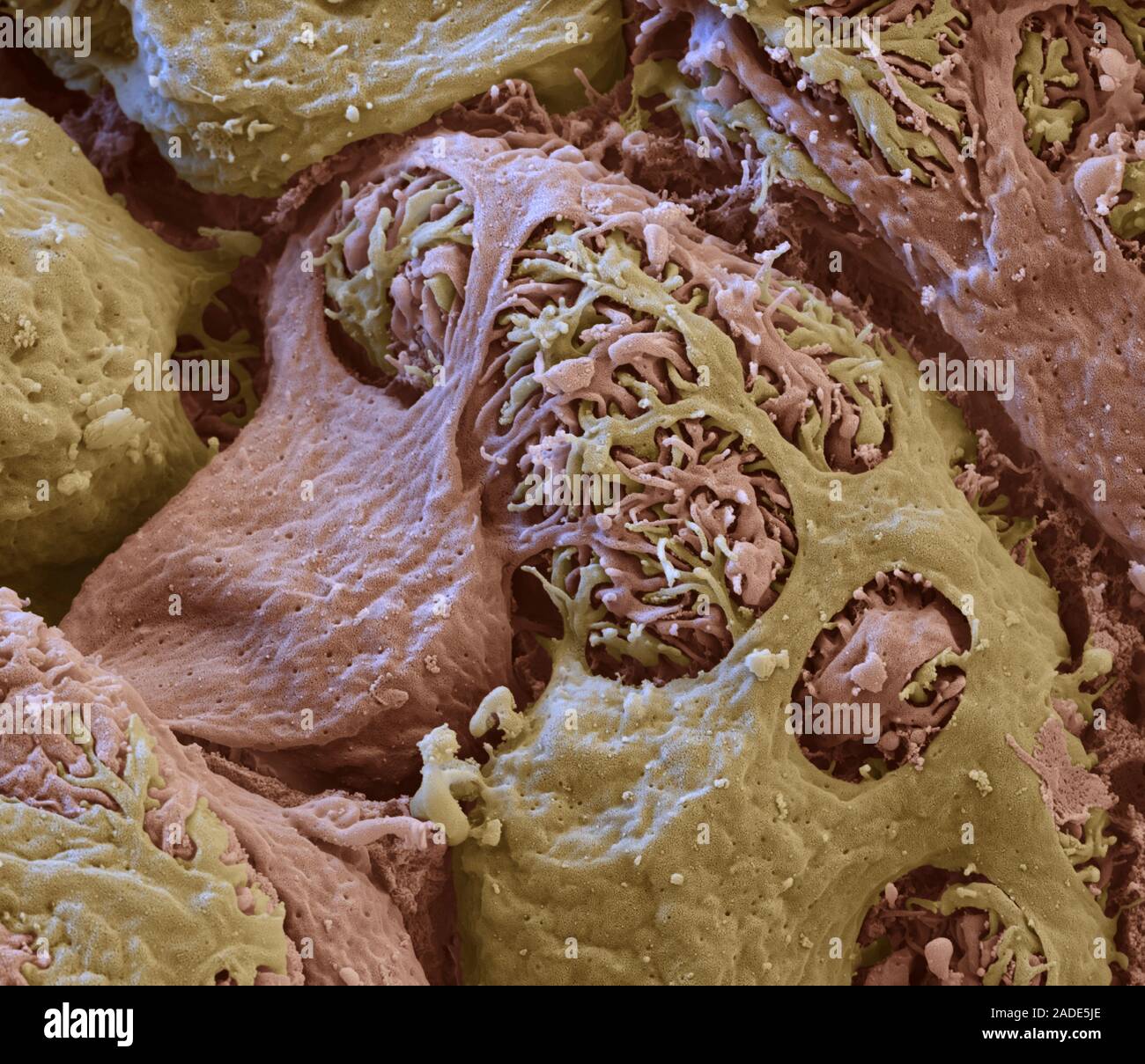 Normal kidney glomerulus. Coloured scanning electron micrograph (SEM ...