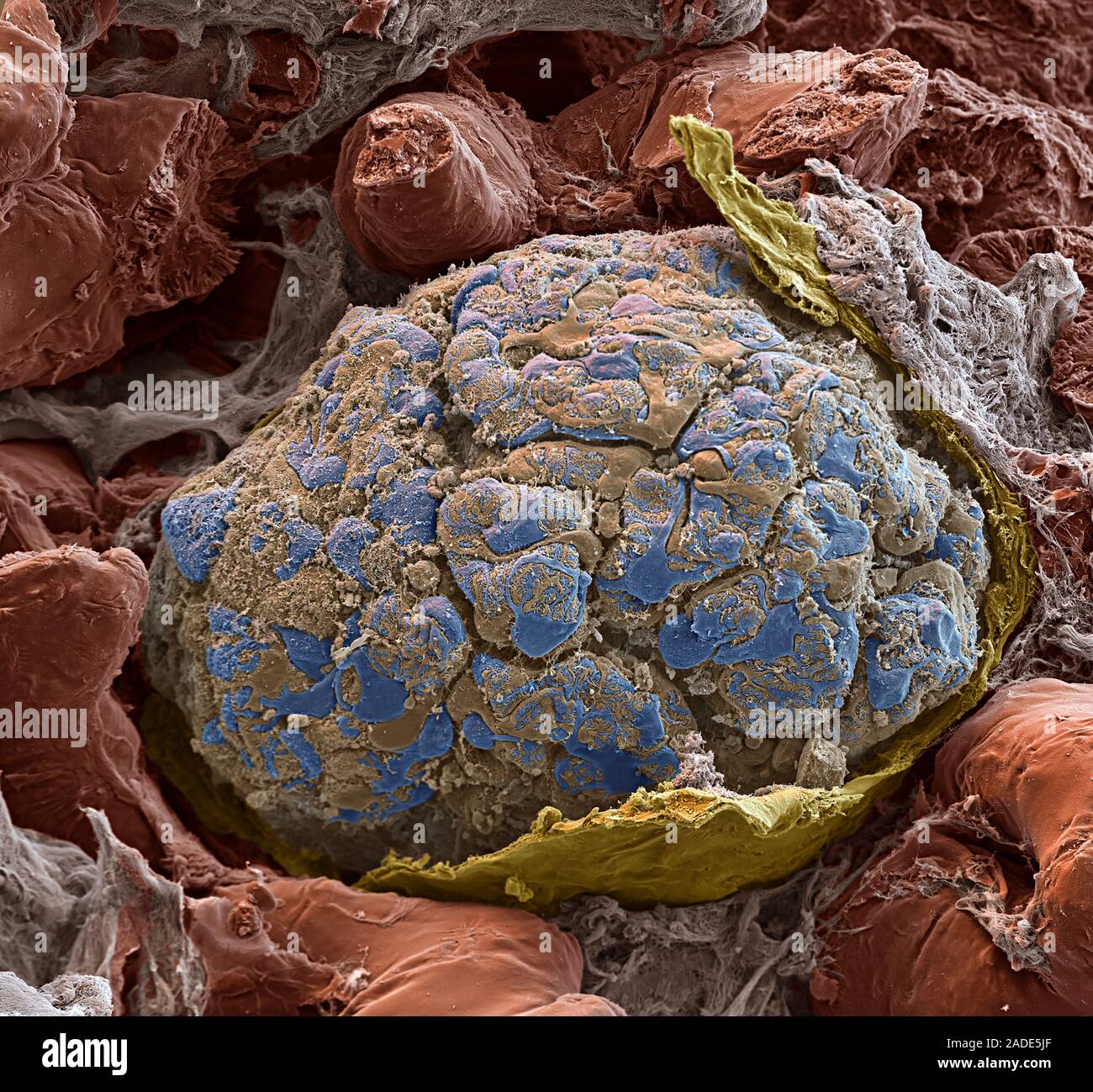 Normal kidney glomerulus. Coloured scanning electron micrograph (SEM ... Normal kidney glomerulus. Coloured scanning electron micrograph (SEM ...