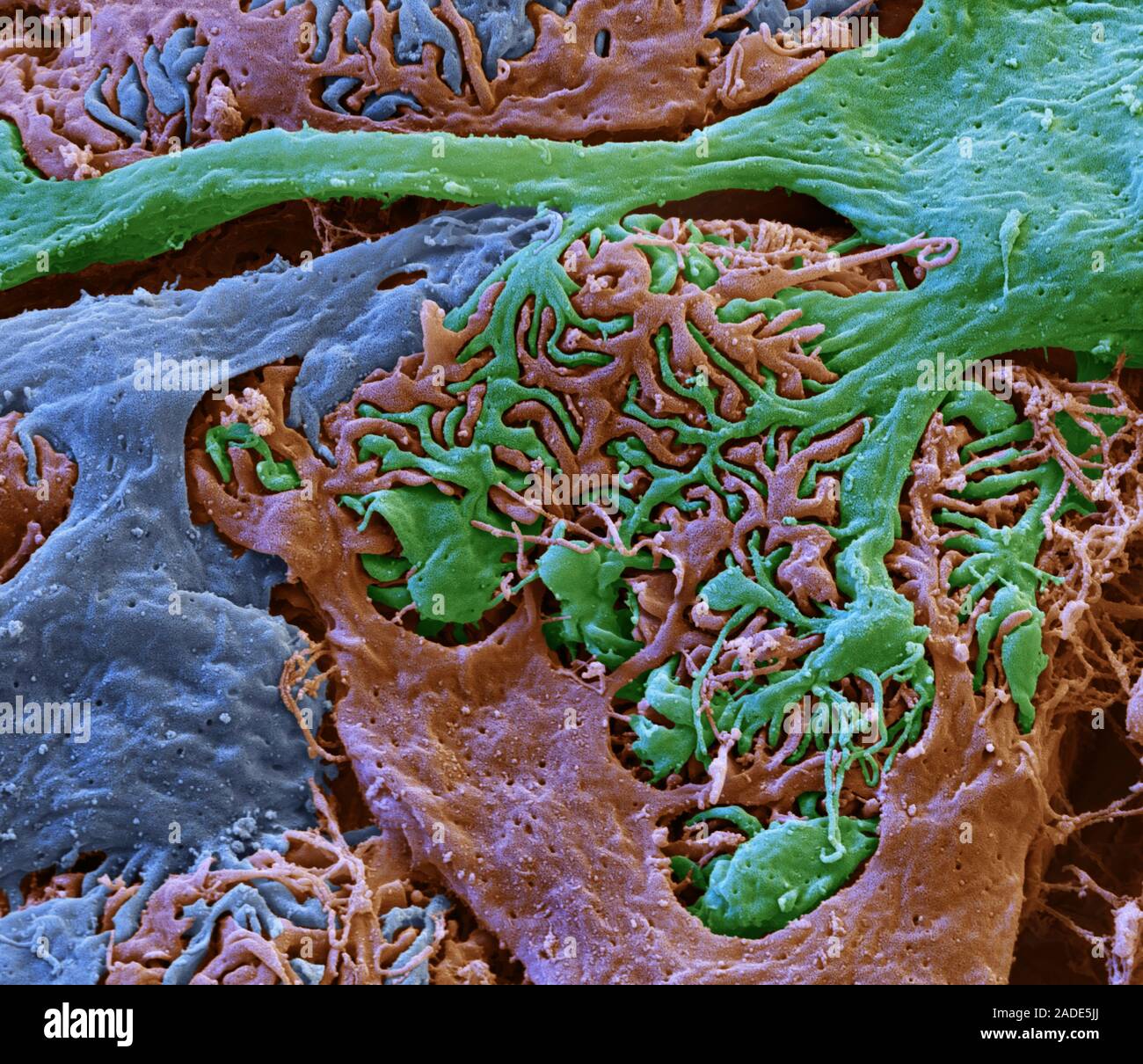 Normal kidney glomerulus. Coloured scanning electron micrograph (SEM ... Normal kidney glomerulus. Coloured scanning electron micrograph (SEM ...