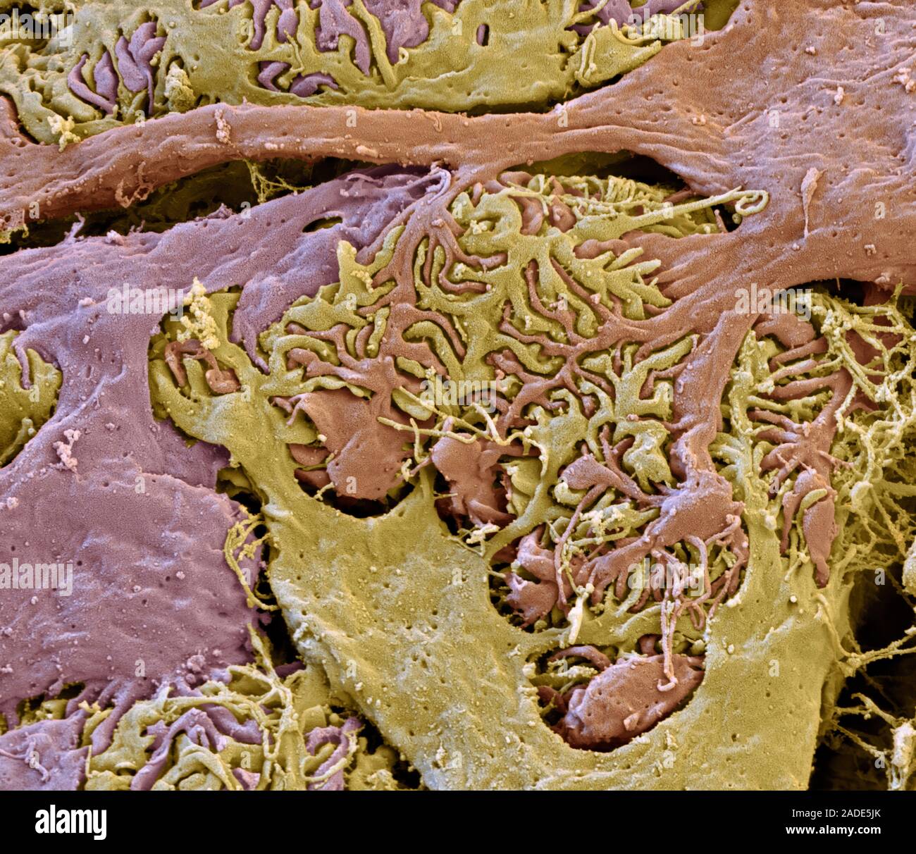 Normal kidney glomerulus. Coloured scanning electron micrograph (SEM ... Normal kidney glomerulus. Coloured scanning electron micrograph (SEM ...