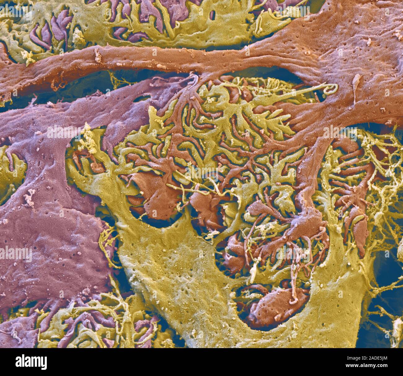 Normal kidney glomerulus. Coloured scanning electron micrograph (SEM ... Normal kidney glomerulus. Coloured scanning electron micrograph (SEM ...