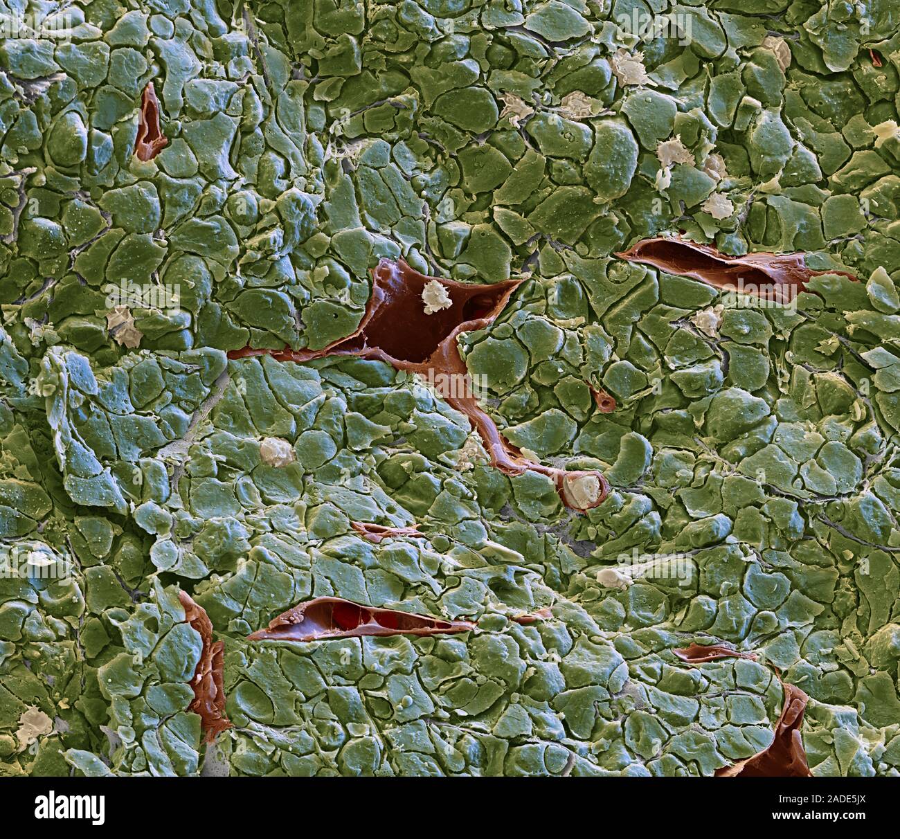 Tumour blood supply and lymphocytes. Coloured scanning electron ...