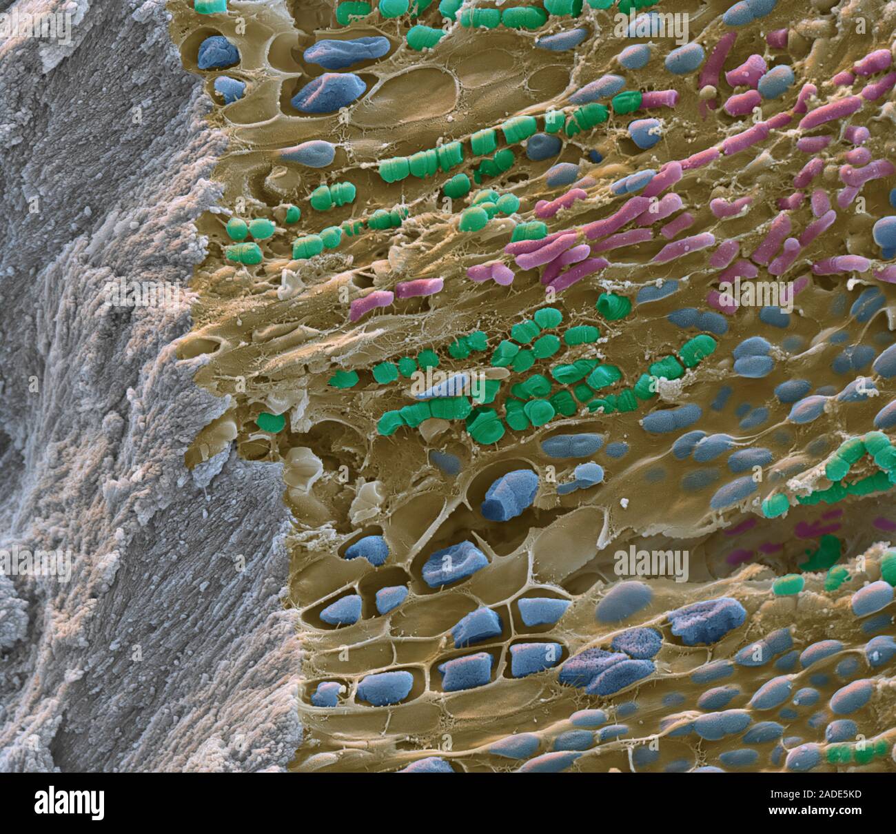 Plaque on tooth. Coloured scanning electron micrograph (SEM) showing a ...
