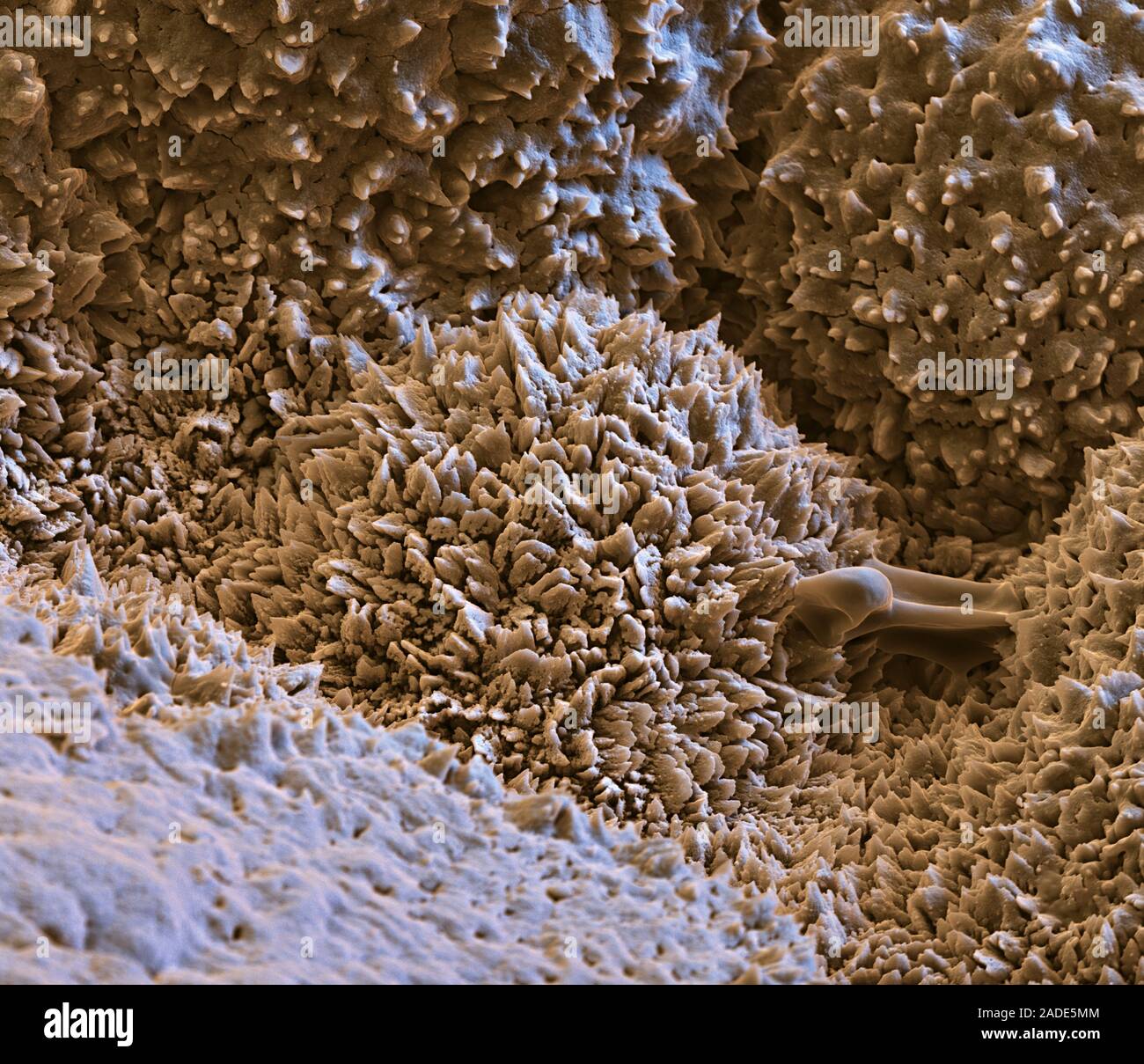 Tropical plant seed. Coloured scanning electron micrograph (SEM) of a ...