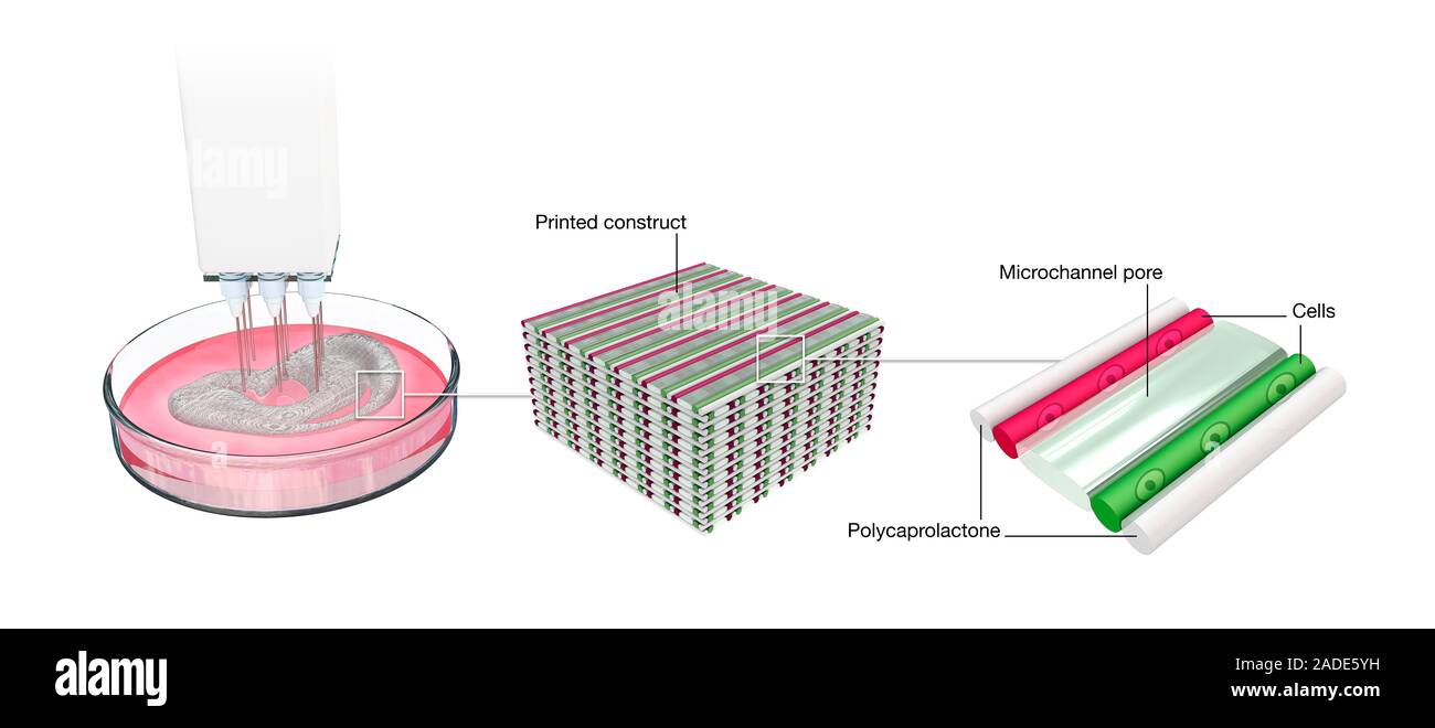 Stages of 3D-bioprinting, illustration. Three-dimensional (3D ...