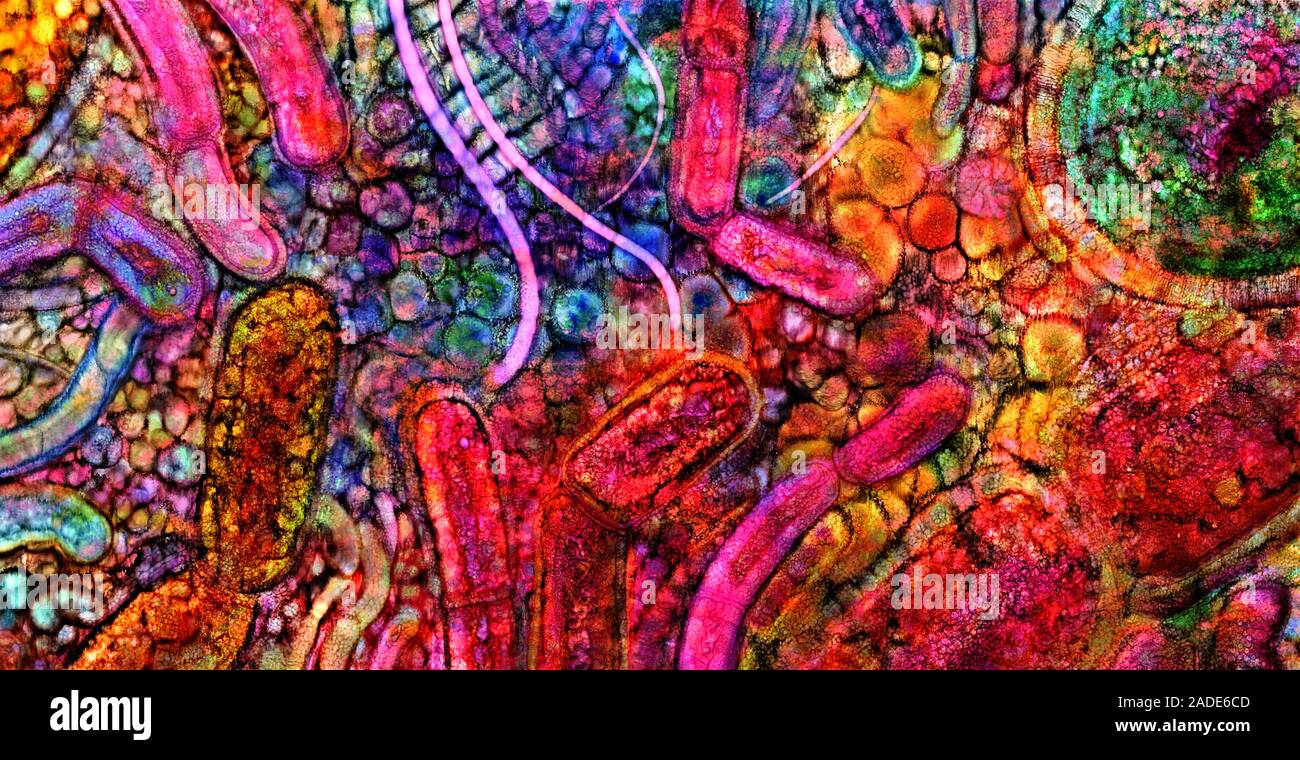 This image may not be used in educational posters Human microbiome ...