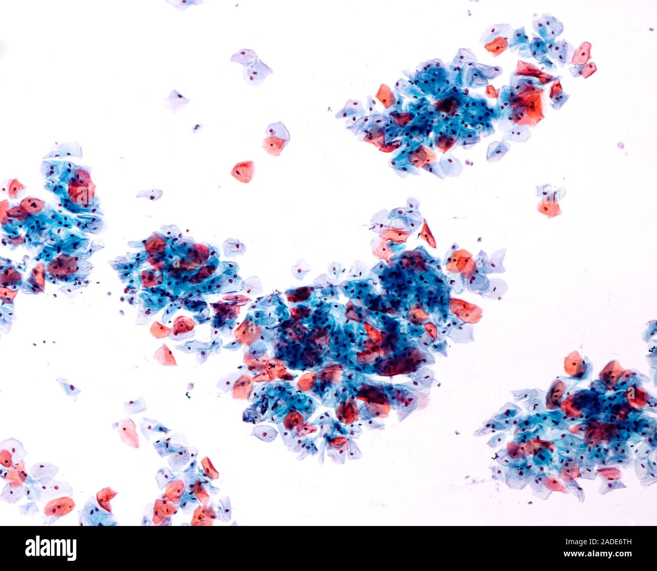 Vaginal smear stained with Papanicolau method, light micrograph. The ...