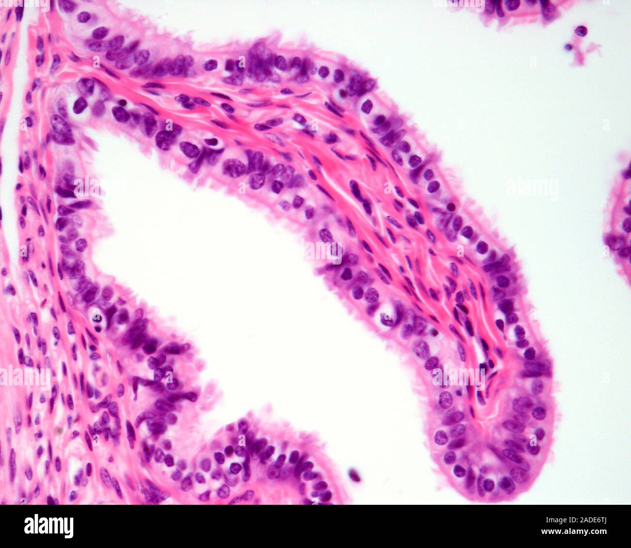 Mucosa of the fallopian tube, light micrograph. The folds of uterine ...