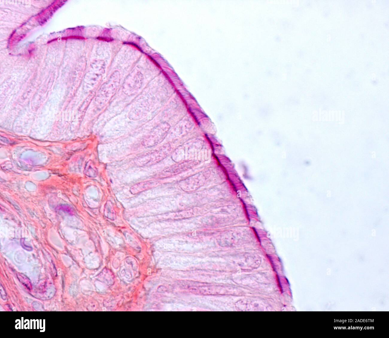 High magnification light micrograph showing the lining of a fallopian ...