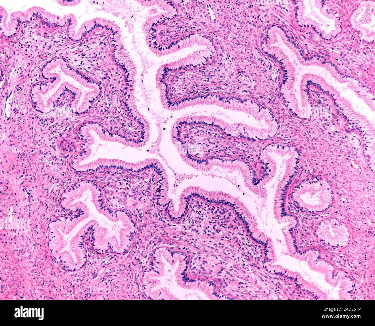Branched tubular glands of the human endocervix mucosa, light ...