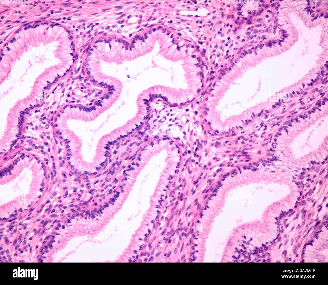 Human endocervix, light micrograph. Endocervical glands lined by a ...