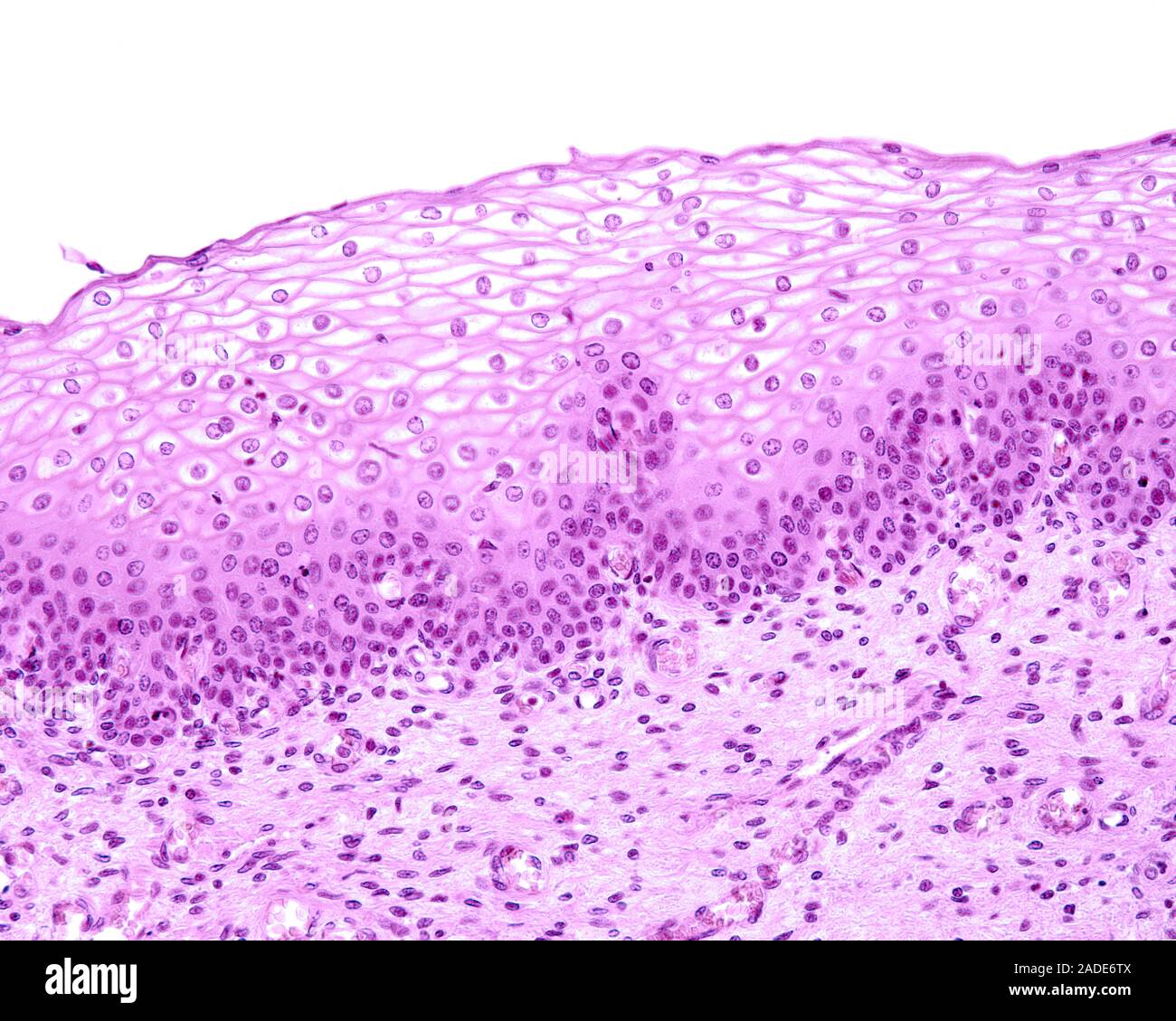 Epithelial lining of the exocervix, light micrograph. This is a non ...
