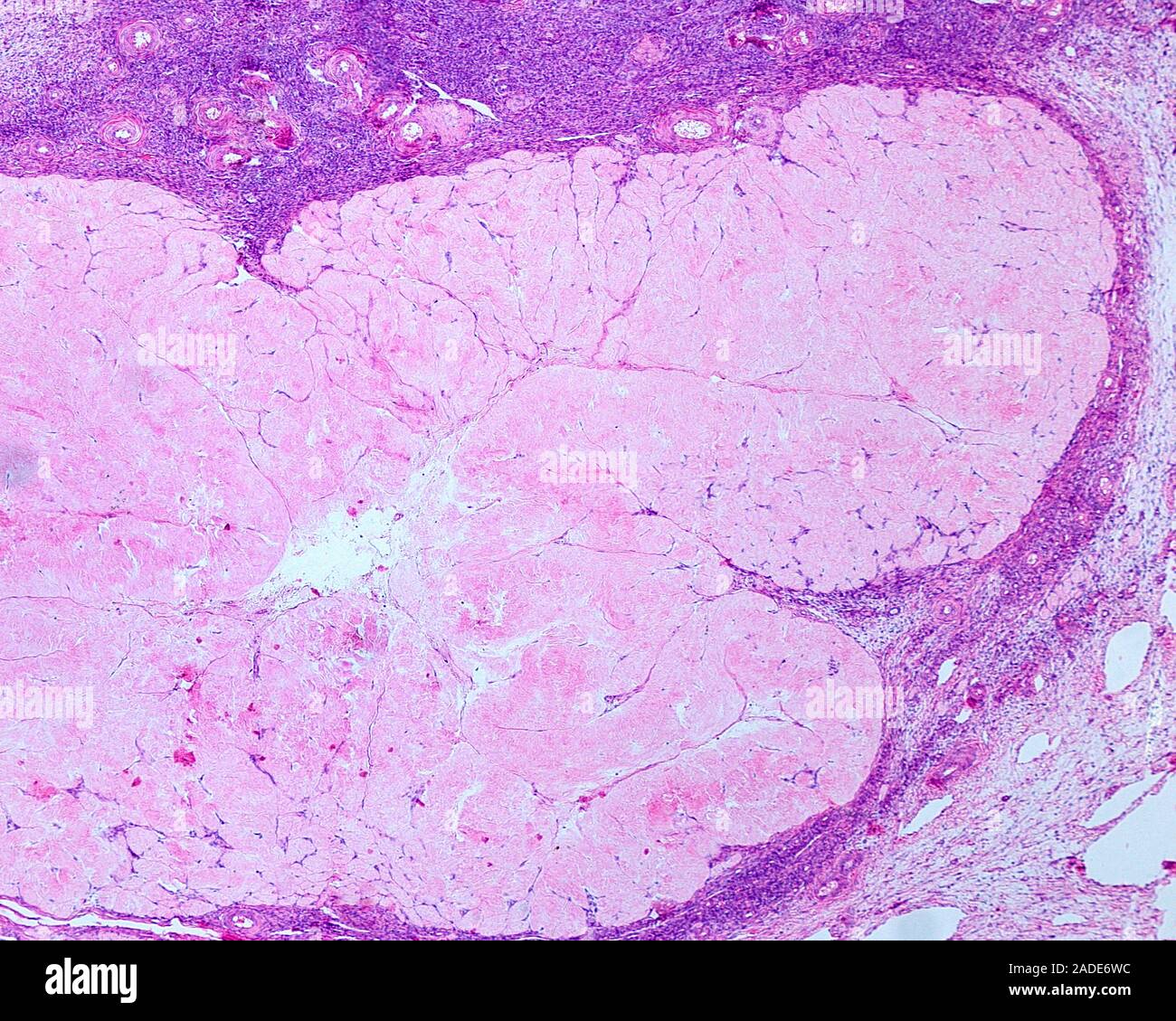 Low magnification light micrograph of a corpus albicans from a human ...