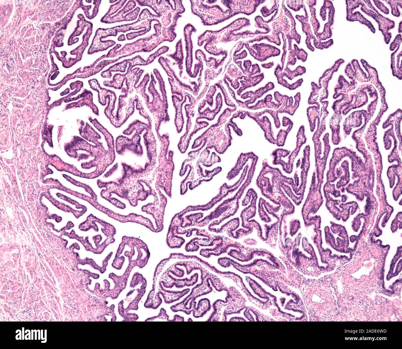 Low magnification light micrograph showing a cross section of a human ...