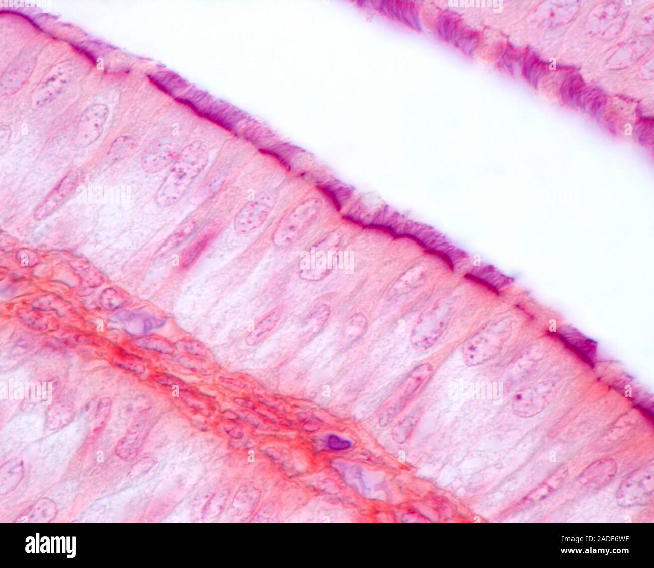 High magnification light micrograph showing the lining of a fallopian ...