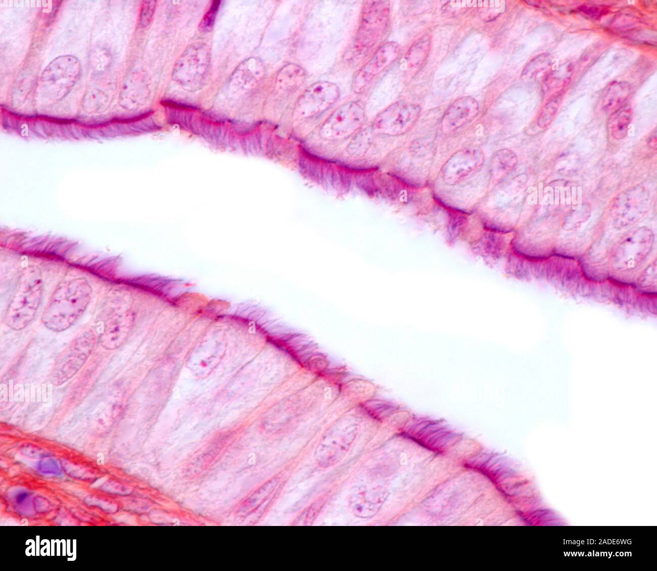 High magnification light micrograph showing the lining of a fallopian ...