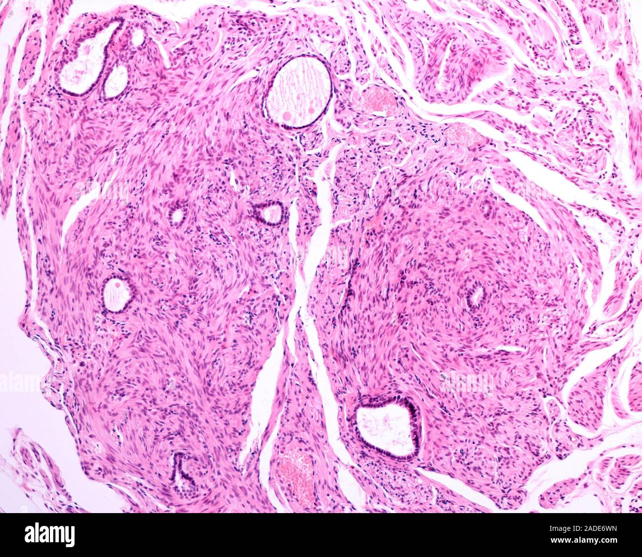 Light micrograph of remnants of mesonephric duct (Wolf duct) located in ...