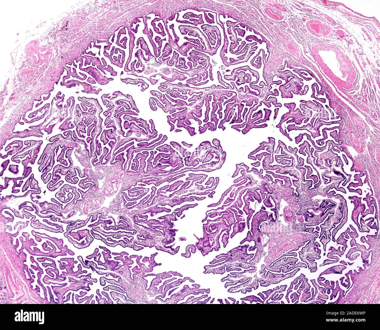 Low magnification light micrograph showing a cross section of a human ...