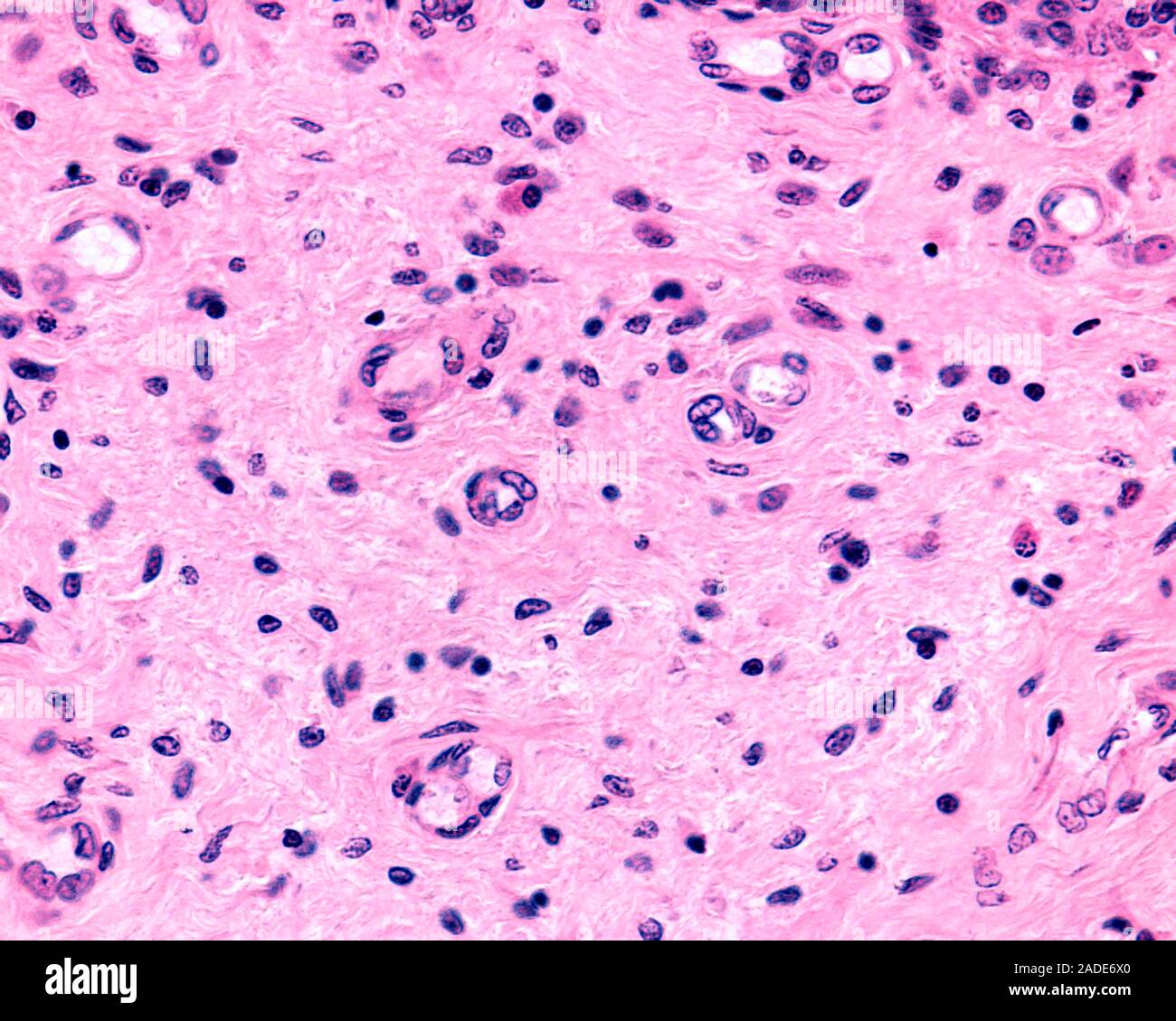 Light micrograph of small blood vessels, mostly arterioles, located in ...