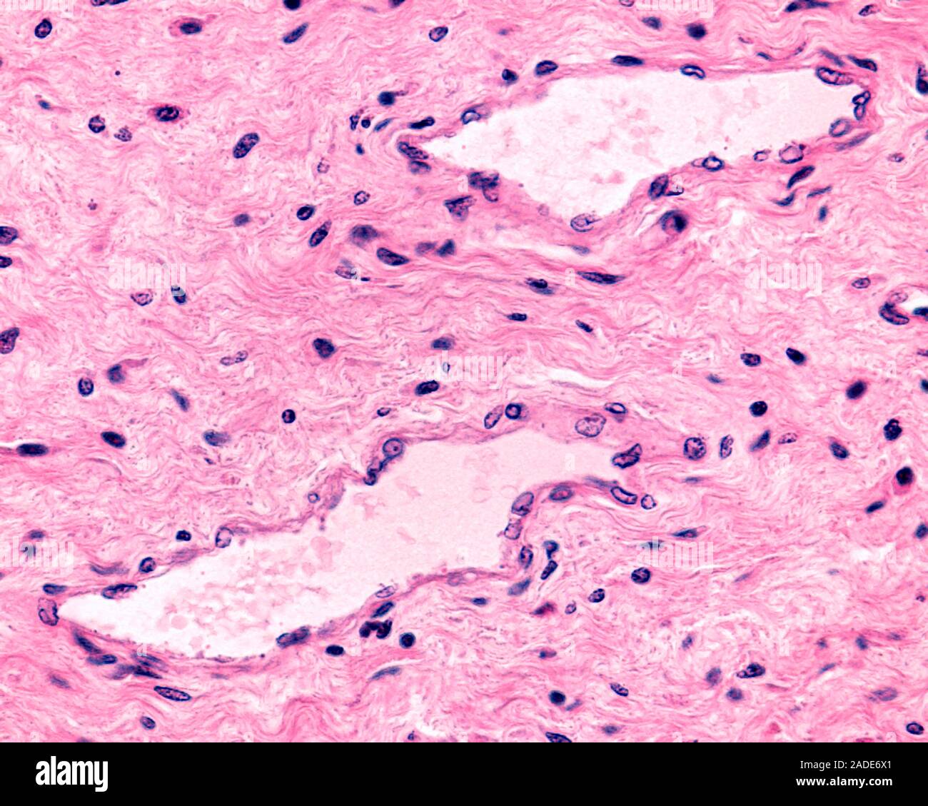 Light micrograph of two small veins located in loose connective tissue ...