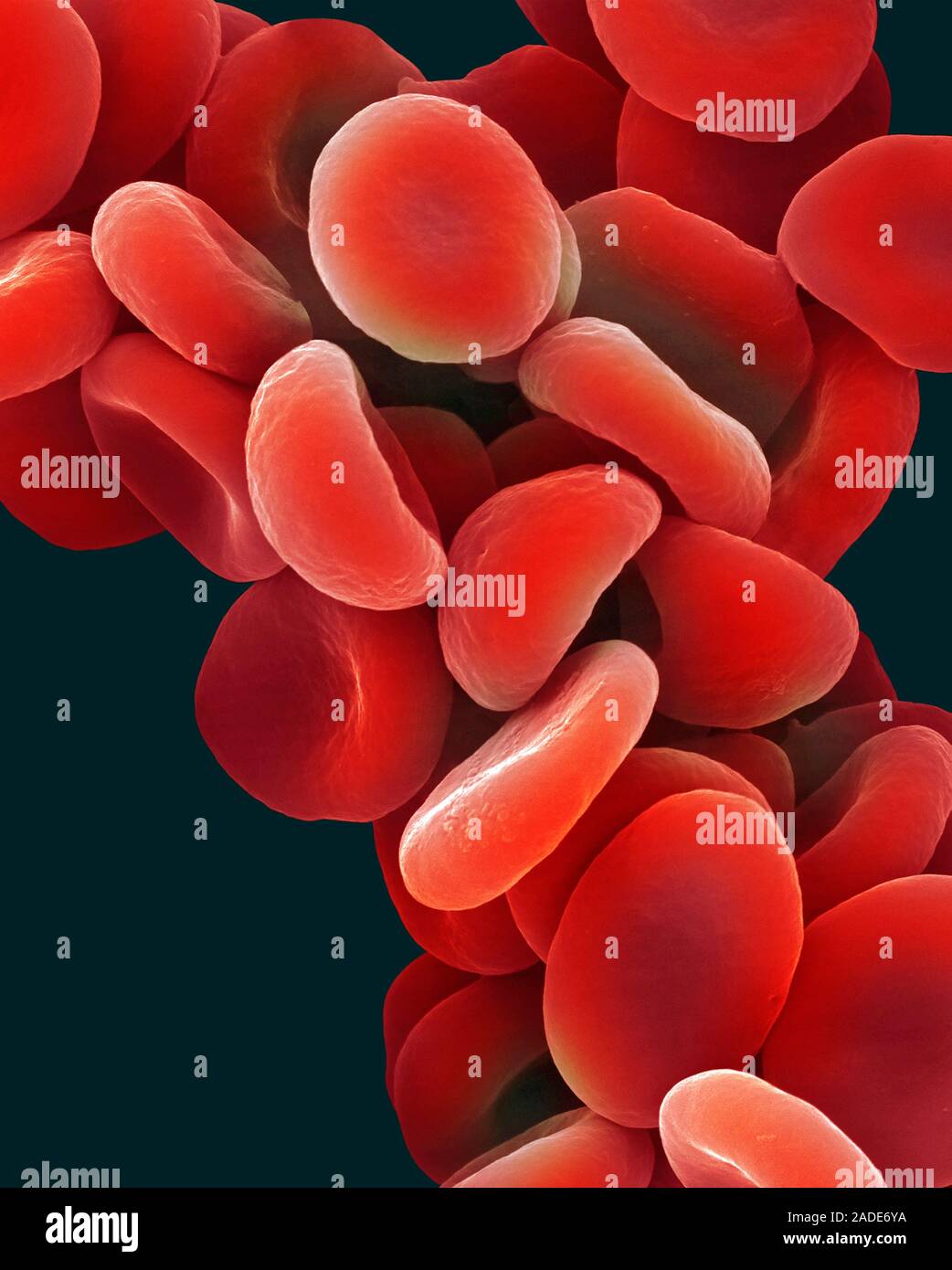 Coloured scanning electron micrograph (SEN) of human red blood cells in ...