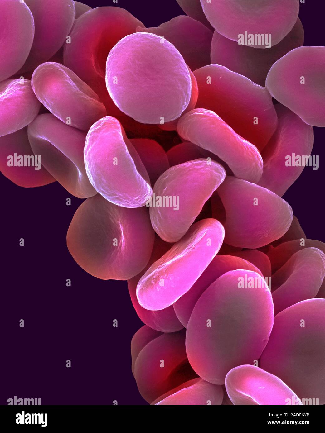 Coloured scanning electron micrograph (SEM) of human red blood cells in ...