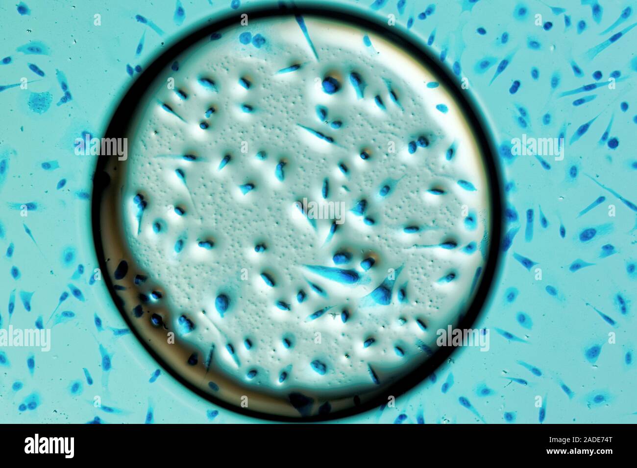 Differential interference contrast (DIC) light micrograph of PC-3 human ...